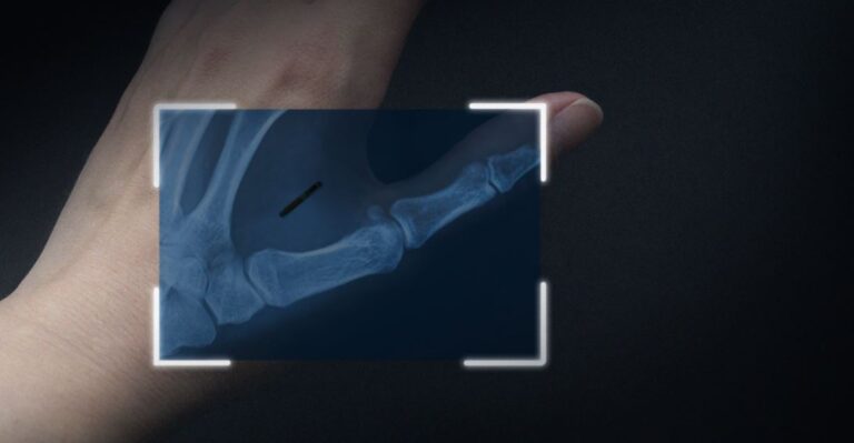 British Company Implants Multi-purpose Microchips To Hands - Teknonel